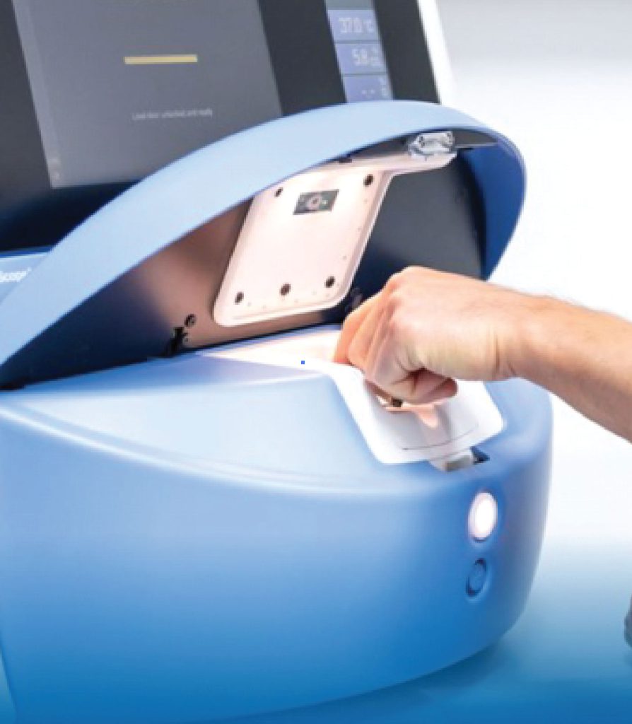 Embryoscope – Cegyr